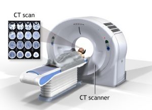 CT Scan Kepala: Fungsi, Prosedur dan Efek Samping - IDN Medis