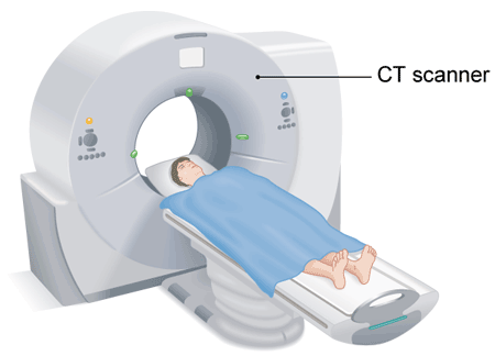 CT Scan: Fungsi, Prosedur, dan Hasilnya - IDN Medis